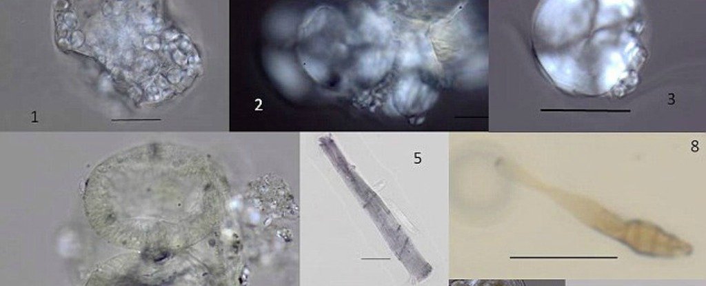 These Microfossils Reveal What Our Ancestors Were Eating 1.2 Million ...