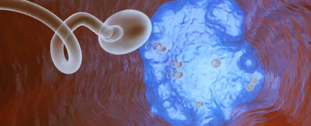 This New Type of Male Contraceptive Not Only Prevents Babies; It's ...