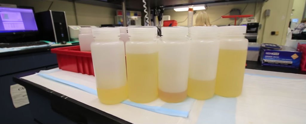 Watch: The Science Behind Why We Burn Astronaut Pee : ScienceAlert