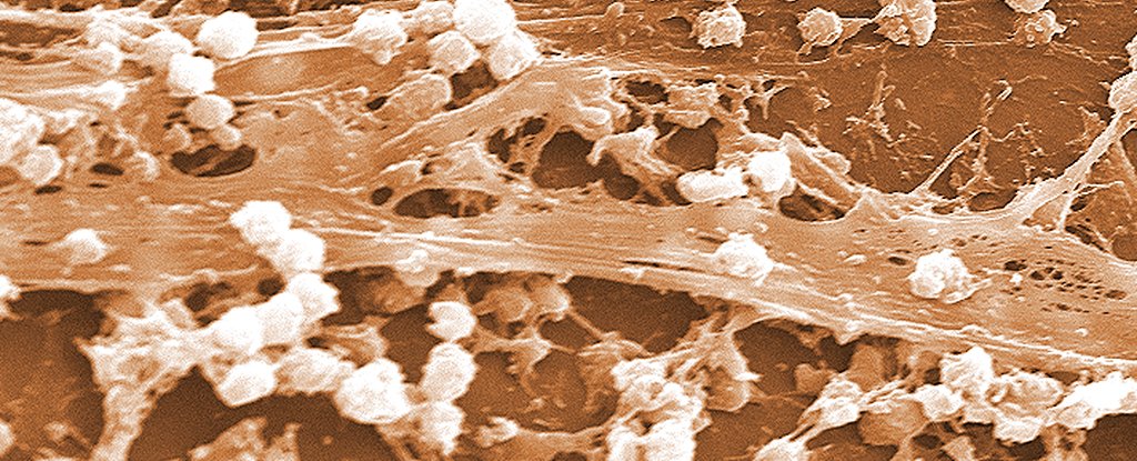 We Now Know Bacteria Can Communicate Electrically, And We Should Be ...