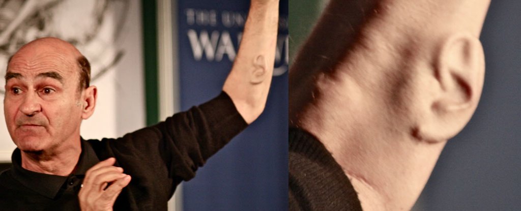 Australian Man Grows Ear on Arm to Make 'Remote Listening Device' For ...