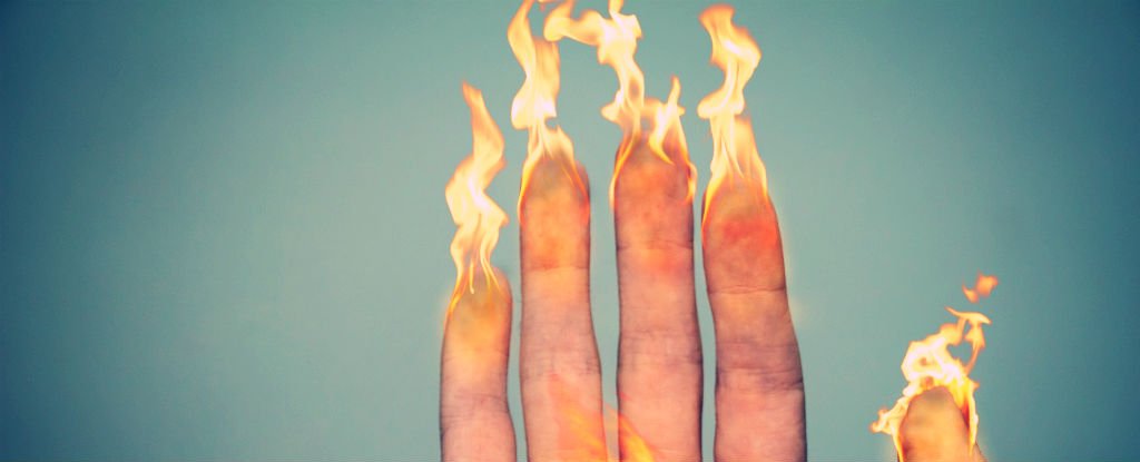 Electrical Burn On Finger