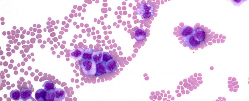 Scientists Transform Human Leukaemia Cells Into Functional Immune Cells ...