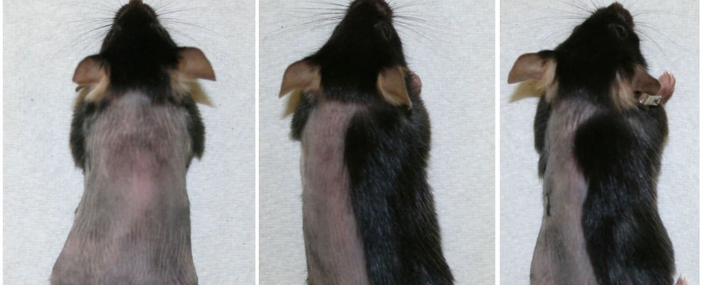 There's a New Drug to Treat Some Types of Baldness - And It Actually ...