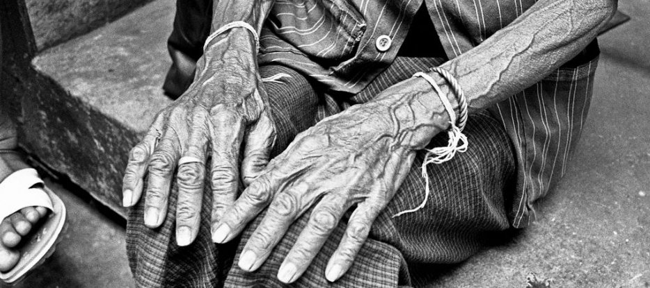 Biologists Discover The Key Mechanism That Triggers Human Ageing ...