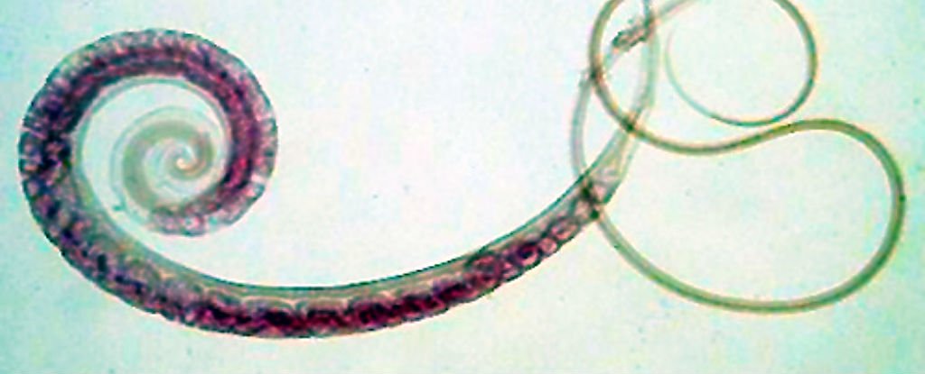 New Leads For Treating Parasitic Worm Disease