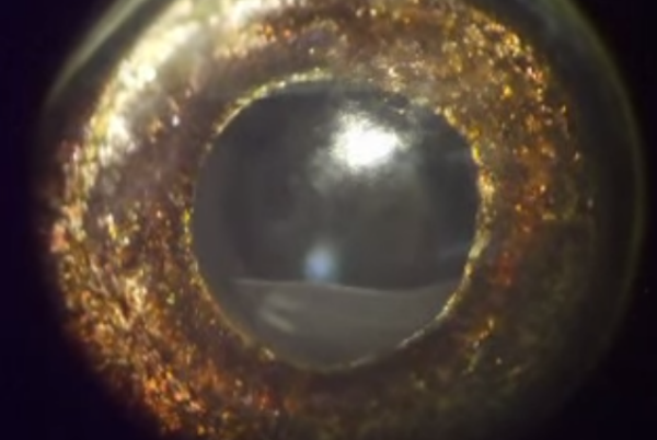 Vril Parasite Eye | Ophthalmic Parasitosis: A Review Article – LJMP